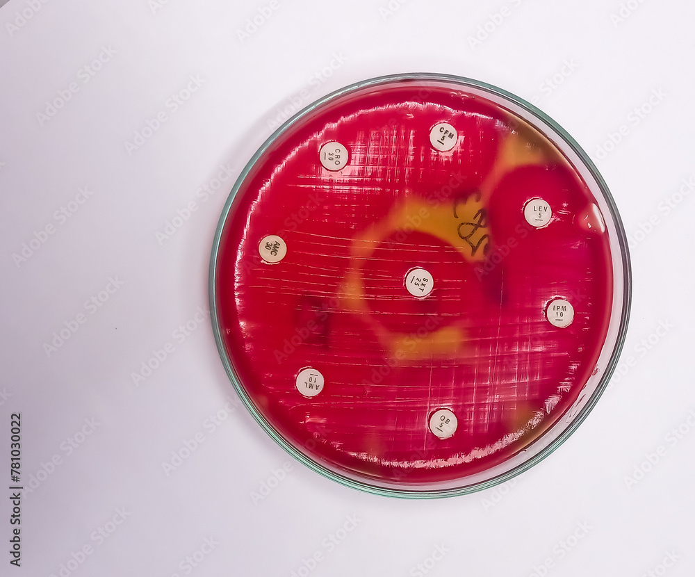 Antimicrobial susceptibility testing in petri dish,Gram-positive coccus ...
