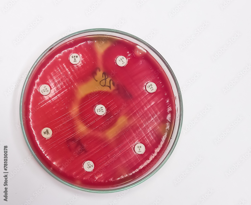 Antimicrobial susceptibility testing in petri dish,Gram-positive coccus ...