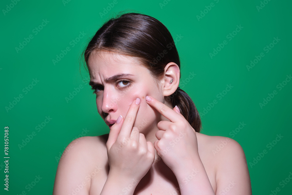 Sad Woman squeeze out pimples on cheek. Acne and pimple on skin ...