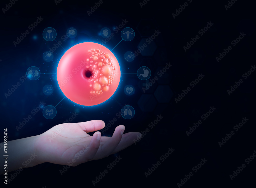 Cervical cancer seen from a speculum. Pap test awareness. The hand ...