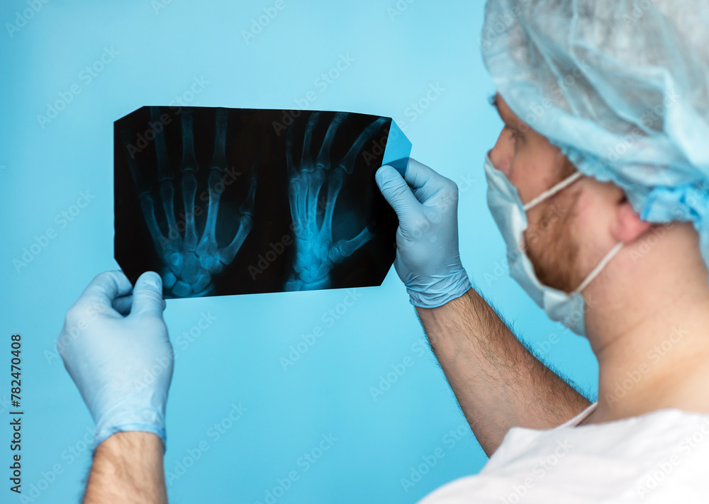 Doctor traumatologist analyzes the trauma of the wrist of a person. X ...
