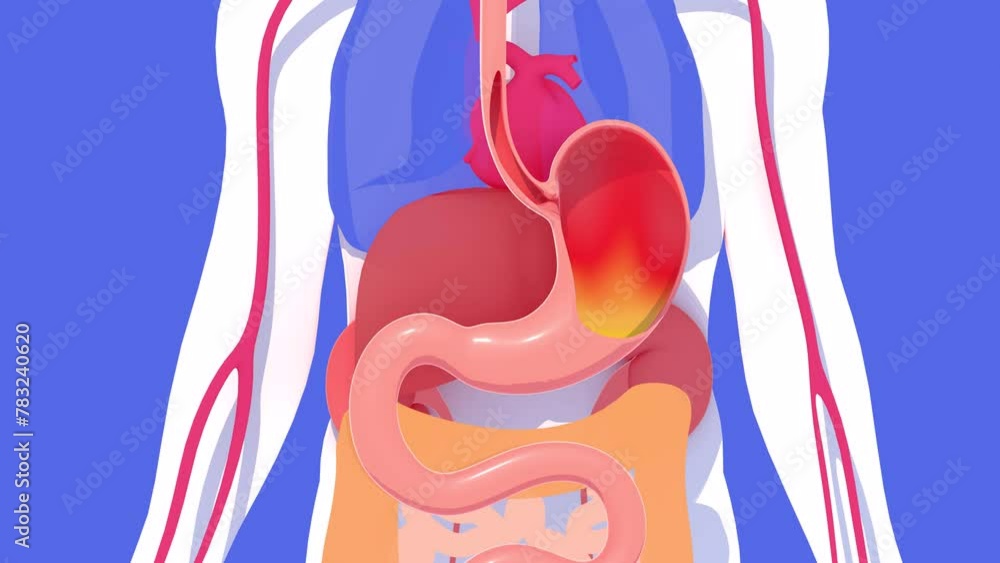 Anatomical 3D animation of the digestive system with burning and ...