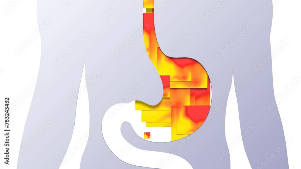 Vidéo Stock Graphic 3D animation of human stomach with heartburn. Fire ...
