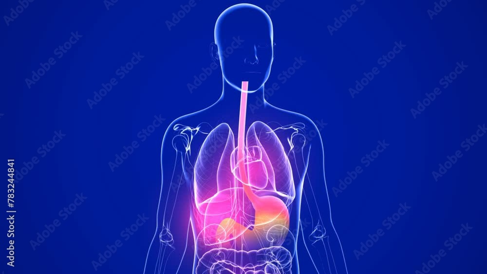 3D animation of stomach with heartburn and reflux. Fire in motion. In a ...