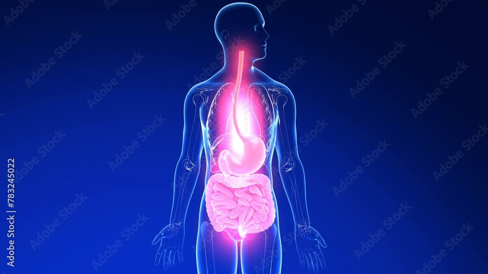 3D animation of the digestive system with heartburn and ...