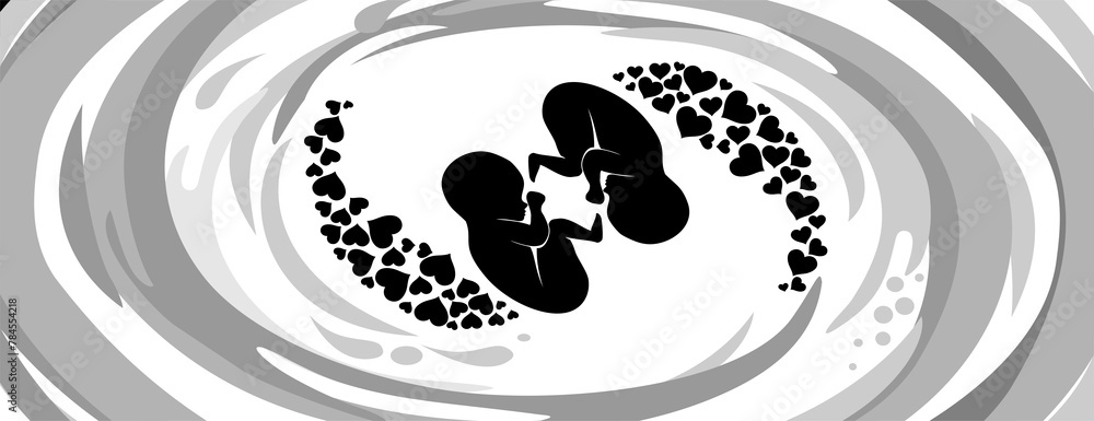 it's twins! Multiple pregnancy. Monozygotic twins (embryos). Design ...