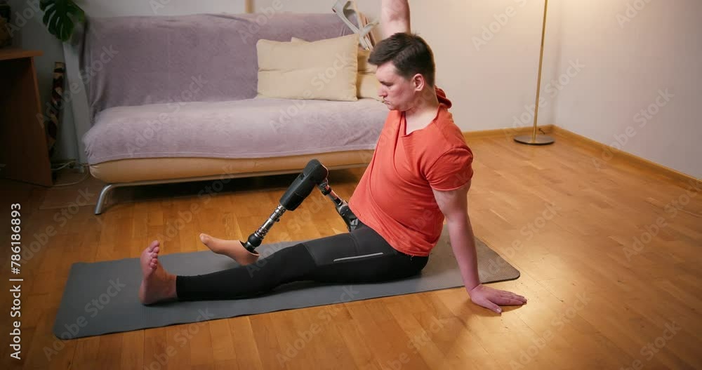 Man amputee with prosthetic leg disability on transfemoral leg ...