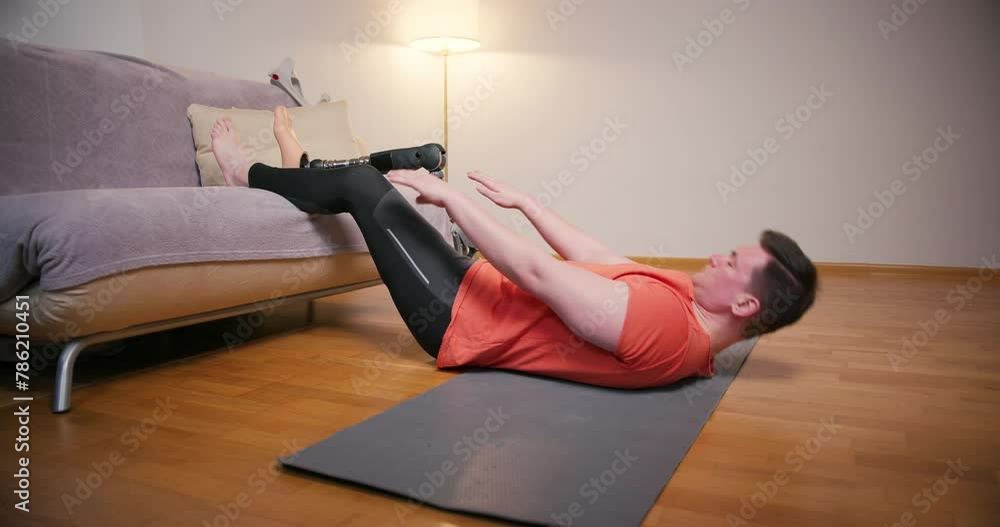 Man amputee with prosthetic leg disability on transfemoral leg ...