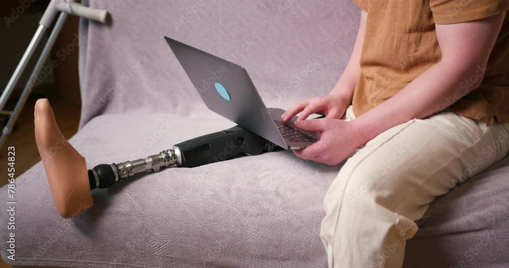 Man amputee with prosthetic leg disability on above knee transfemoral ...