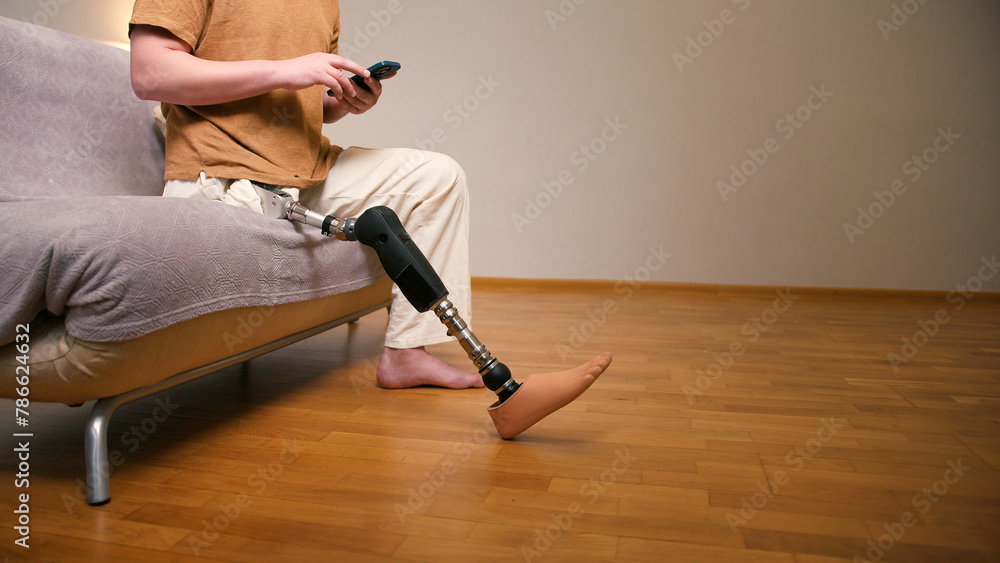 Man amputee with prosthetic leg disability on above knee transfemoral ...
