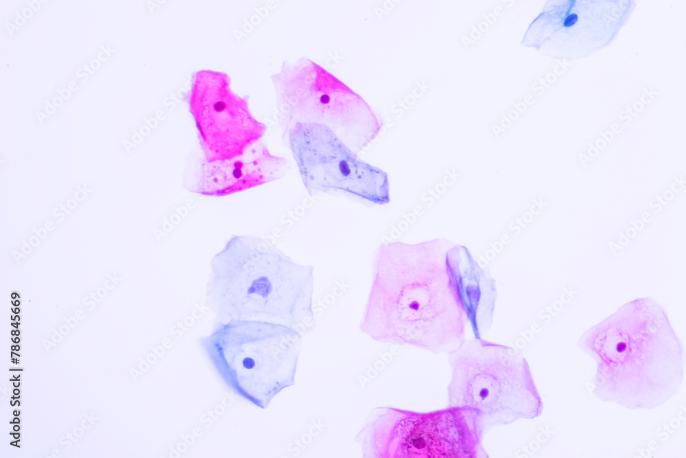 View in microscopic of human skin cells.Squamous epithelium cells ...