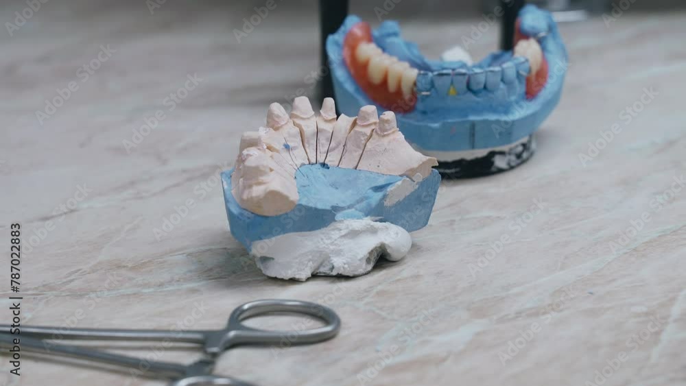 There are parts of the upper and lower parts of the denture model on ...