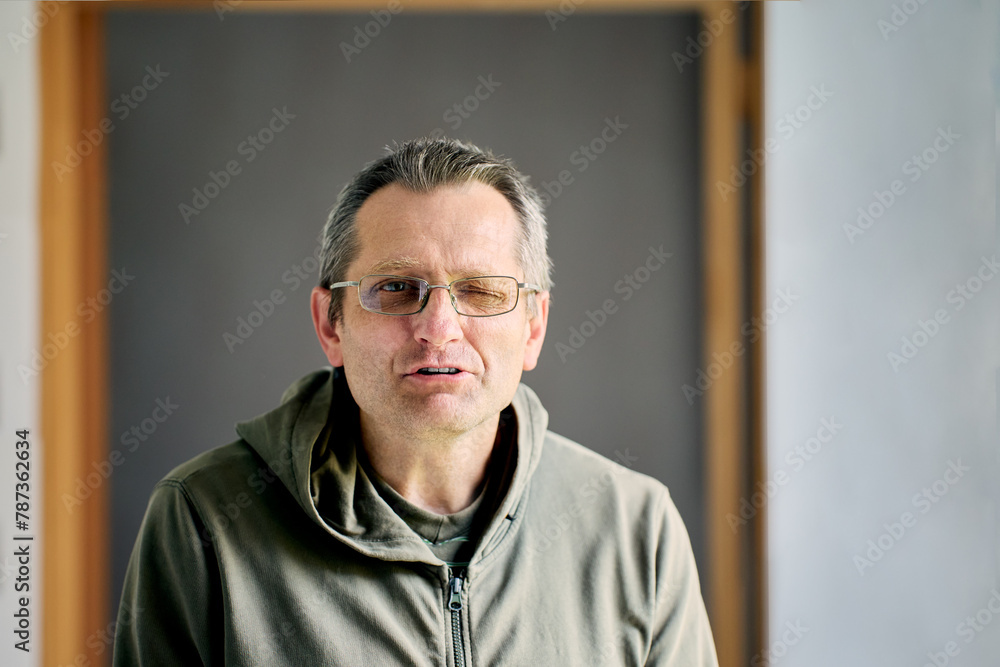 Poster Optic nerve palsy and upper eyelid ptosis or drooping eyelid in ...