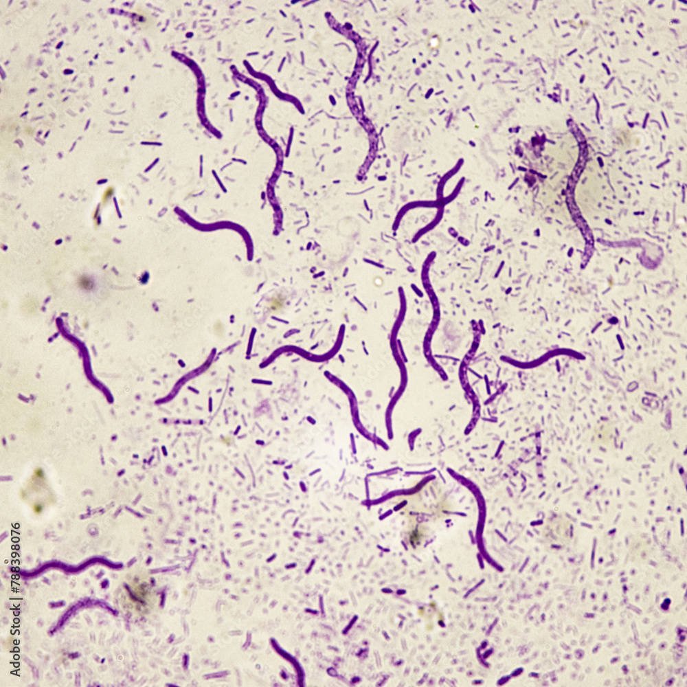 Crimson red spirochetes is a spiral shaped bacterium that is Gram ...