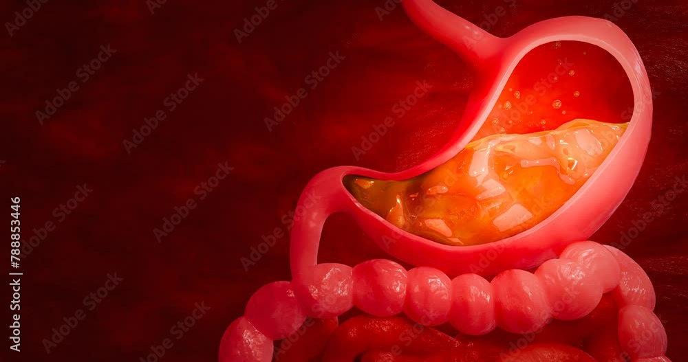 Vidéo Stock Symptoms of acid reflux or excess acid in the stomach ...