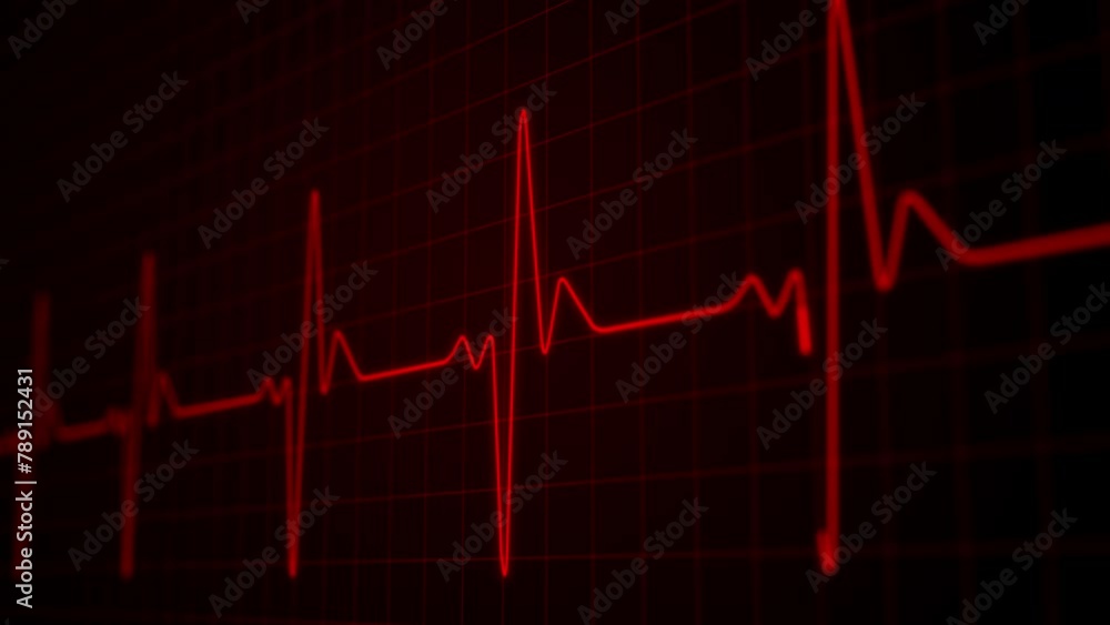 Vidéo Stock Patient monitor displays vital signs ECG electrocardiogram ...