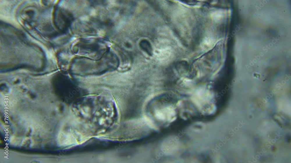 Under 1000x magnification, particles and organisms in a probiotic ...