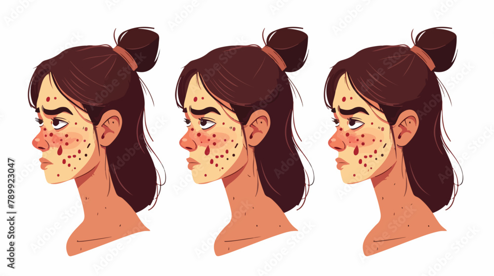 Cartoon woman with acne skin problem. Hand drawn style Stock Vector ...