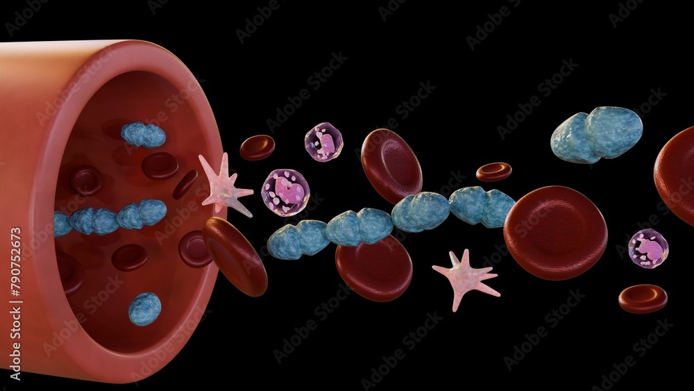 3d rendering of Septicemia, or sepsis, is the clinical name for blood ...