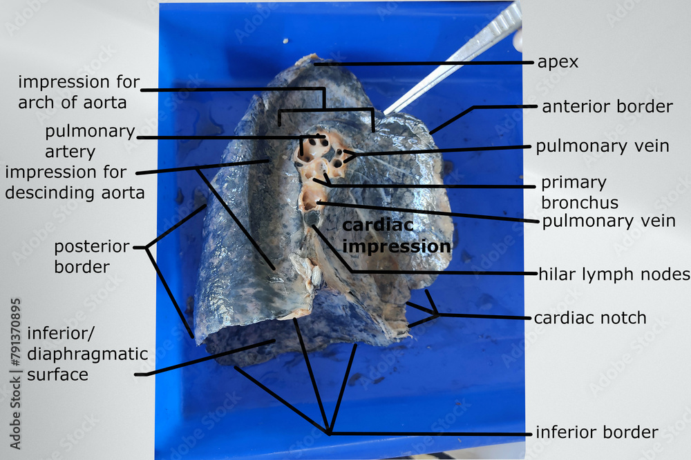 anatomy of left lung showing its surface, border and the features of ...