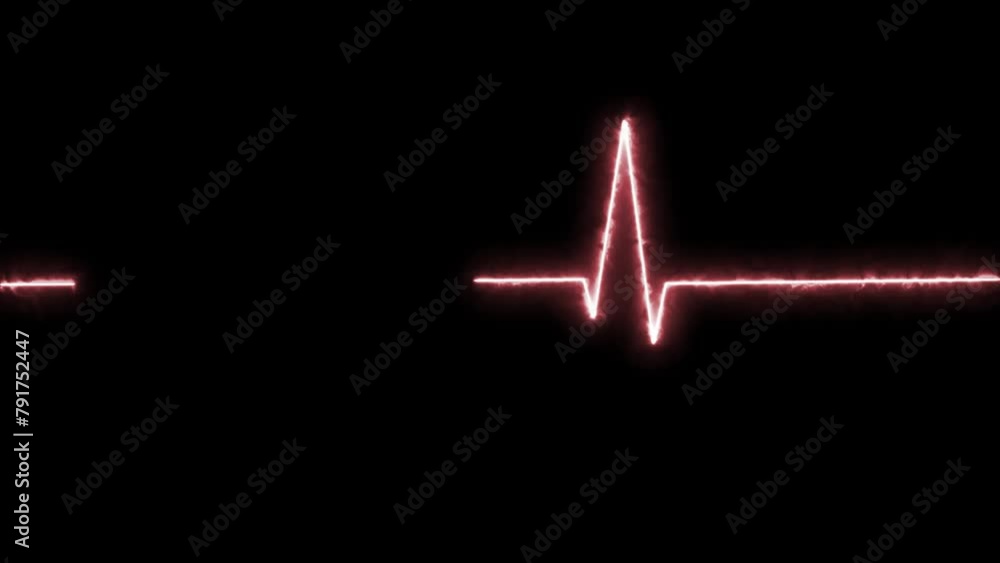 Heartbeat Monitor Animated Video, Heartbeat Medical Cardiogram ...