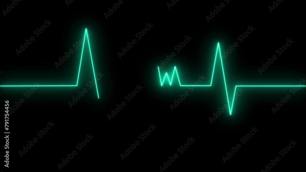 Heartbeat Monitor Animated Video, Heartbeat Medical Cardiogram ...