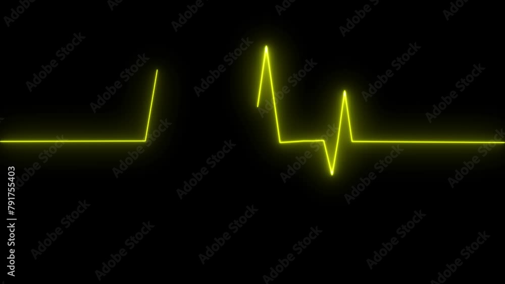 Heartbeat Monitor Animated Video, Heartbeat Medical Cardiogram ...