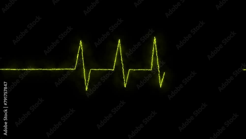 Heartbeat Monitor Animated Video, Heartbeat Medical Cardiogram ...