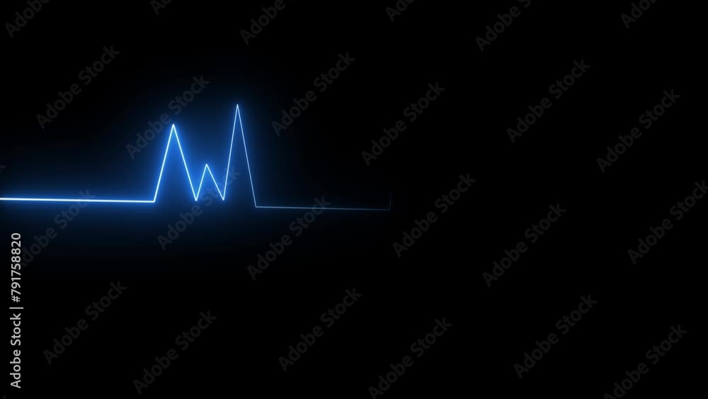 Heartbeat Monitor Animated Video, Heartbeat Medical Cardiogram ...