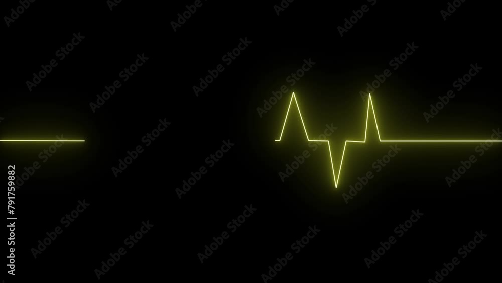 Heartbeat Monitor Animated Video, Heartbeat Medical Cardiogram ...