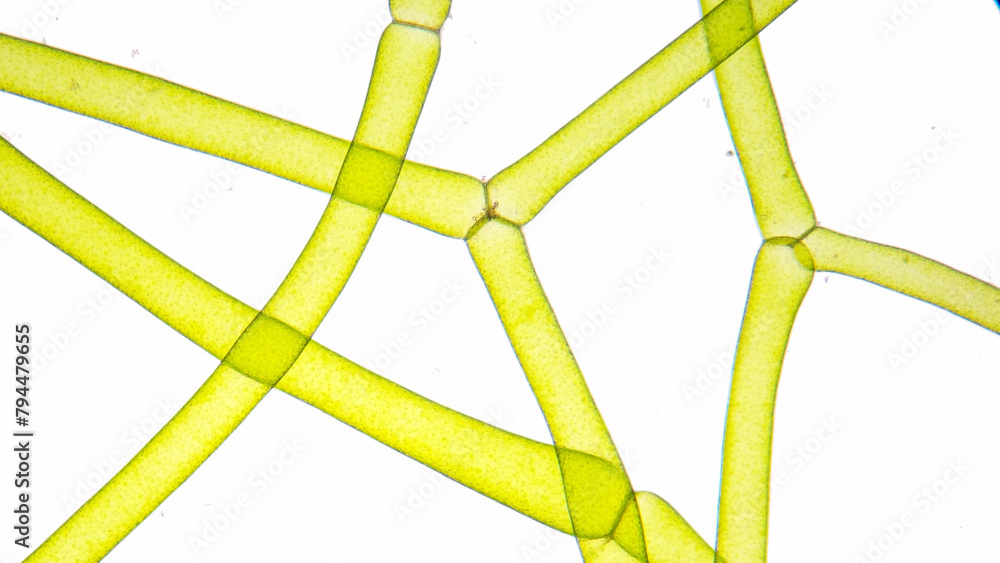 The water net (Hydrodictyon sp) under microscope. Collected from paddy ...