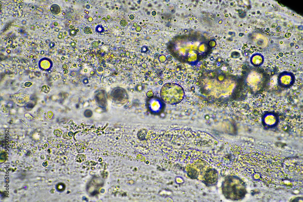 green mucus and coughing up phlegm under the microscope looking at ...