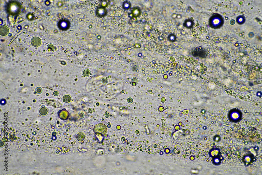 Coughing up mucus and phlegm from a chest infection from a virus and ...