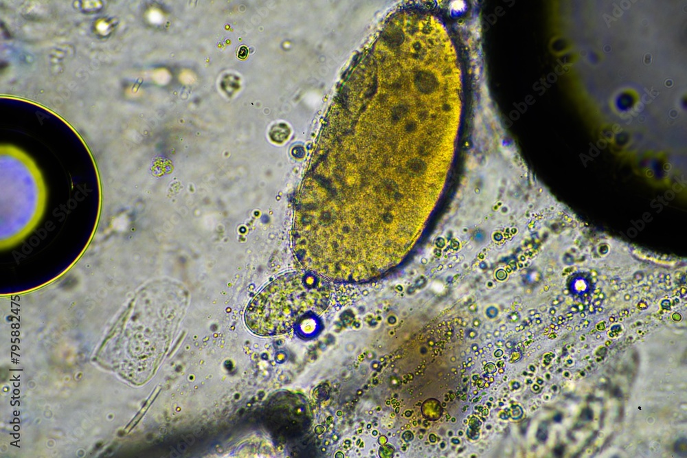 green mucus and coughing up phlegm under the microscope looking at ...