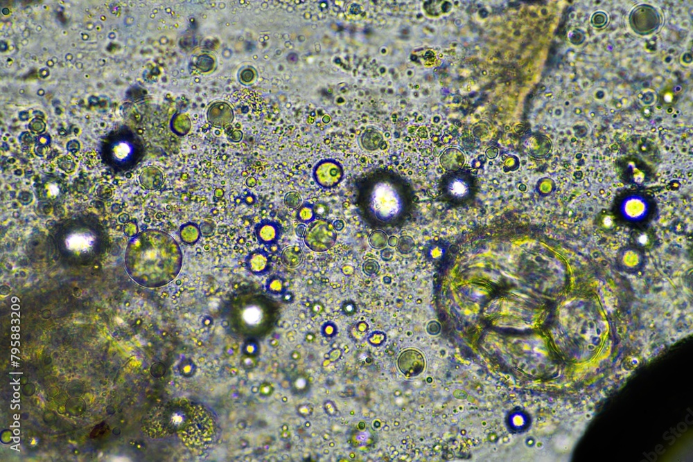 green mucus and coughing up phlegm under the microscope looking at ...