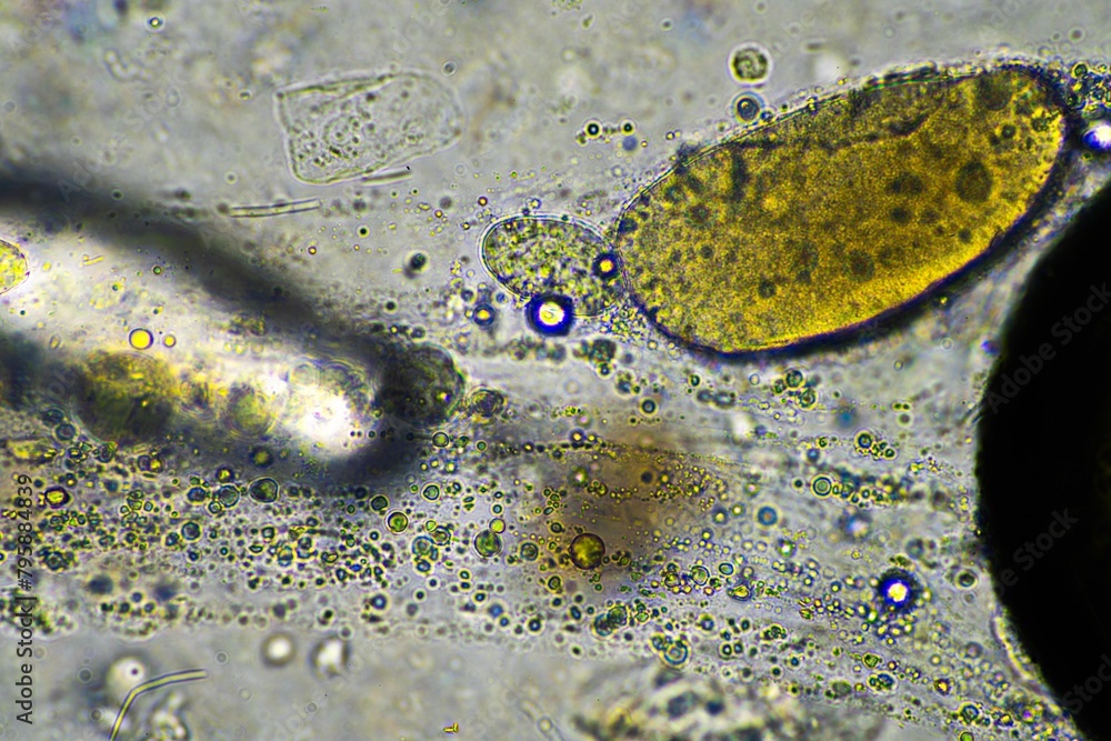 Coughing up mucus and phlegm from a chest infection from a virus and ...