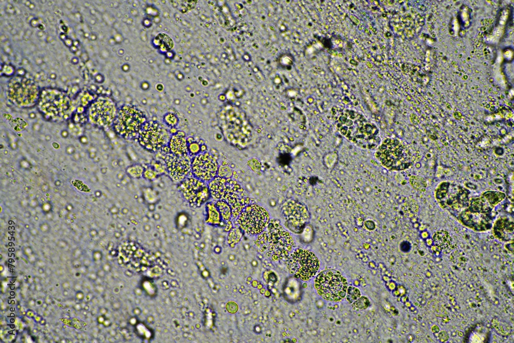 green mucus and coughing up phlegm under the microscope looking at ...