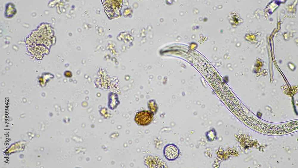 soil microorganisms including nematode, microarthropods, micro ...