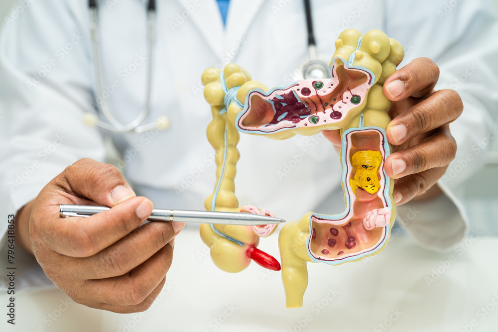 Poster Intestine, appendix and digestive system, doctor holding anatomy ...