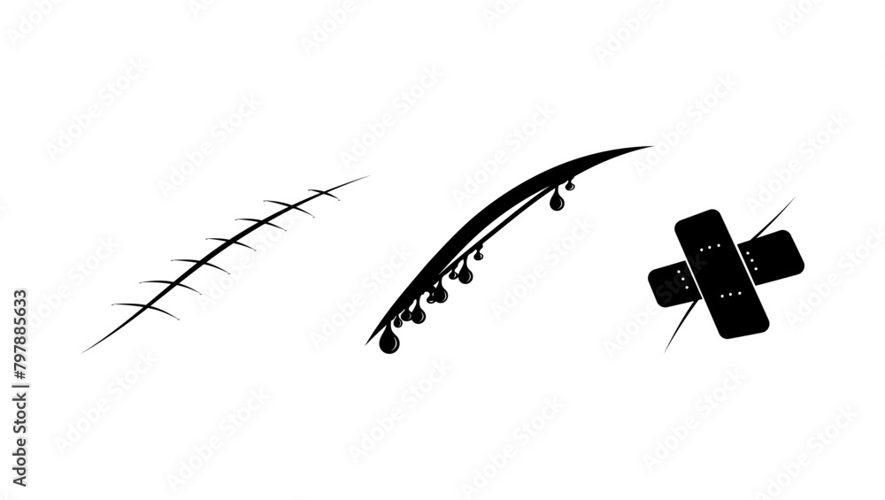 cut, wound, stitch on a wound, black isolated silhouette Stock Vector ...