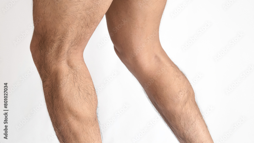 Muscular legs of a man, calves of both feet seen from the side, with a ...