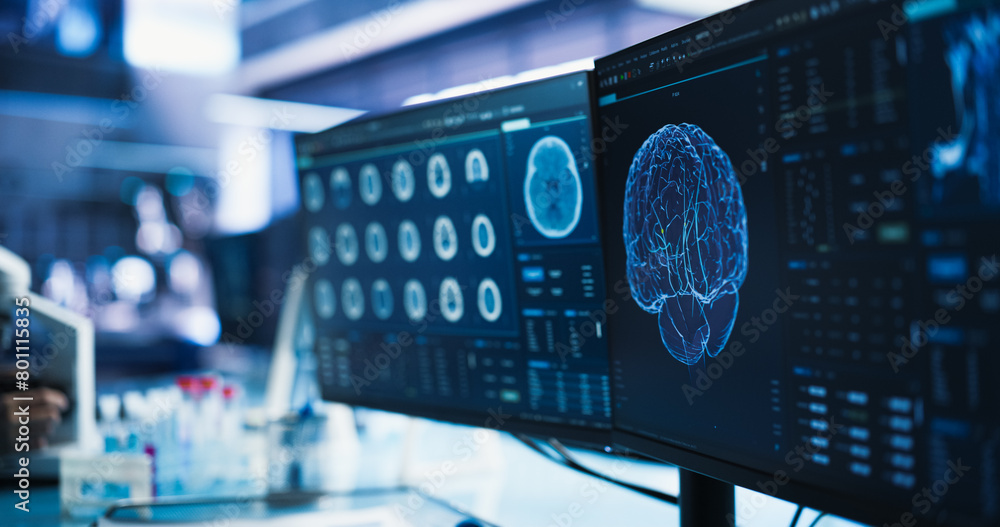 Cancer Research Center Medical Laboratory: Close Up of a Set of Desktop ...