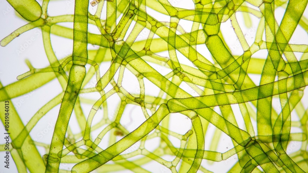 The water net (Hydrodictyon sp) under microscope. Collected from paddy ...