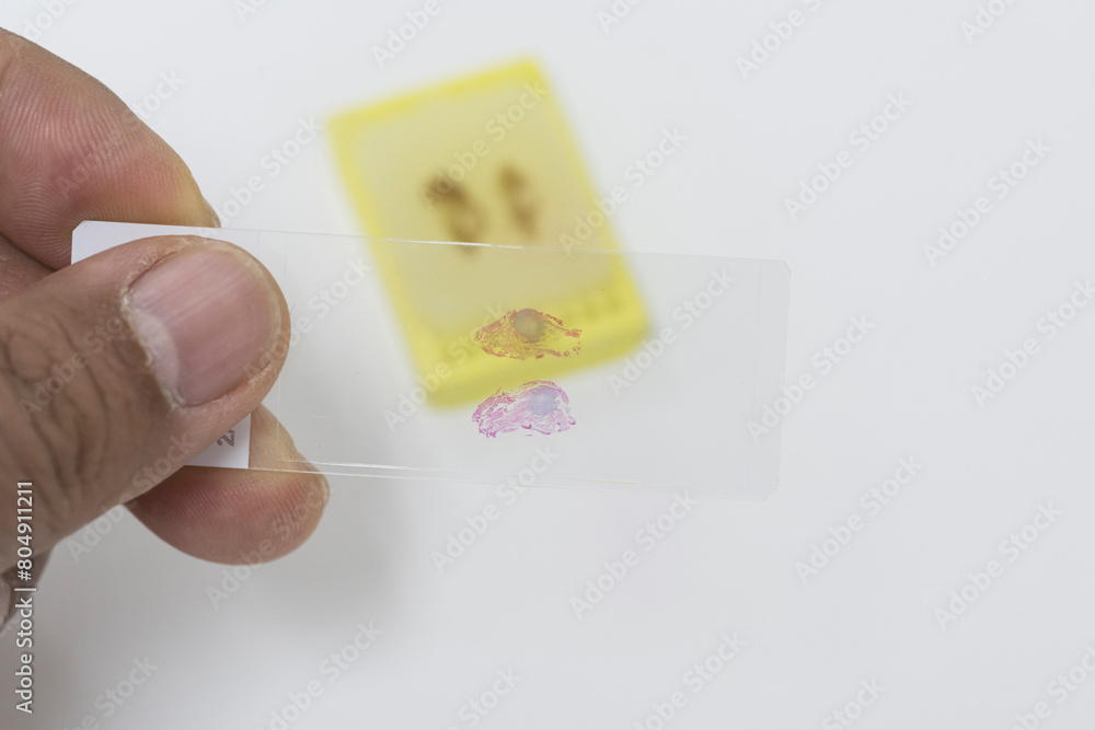 Scientist hand holding slide and out of focus paraffin human tissue ...