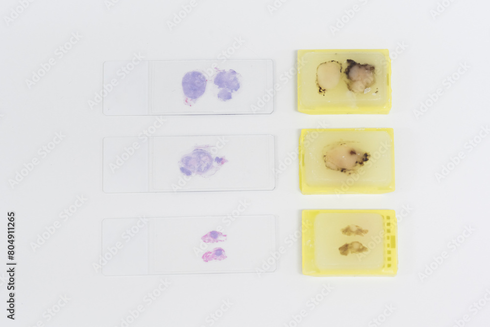 Paraffin box human tissue and glasse slide Hemotoxylin and Eosin stain ...