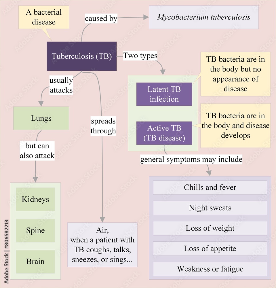 Tuberculosis (TB) is caused by bacteria, Mycobacterium tuberculosis ...