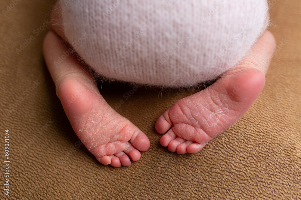 the legs of the newborn baby. the legs of the newborn flaky skin. peel ...