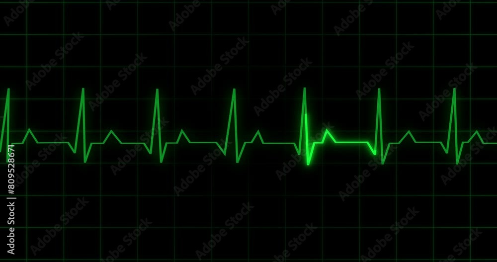 EKG Heartbeat reading animation on black background in 4K. Medical ...
