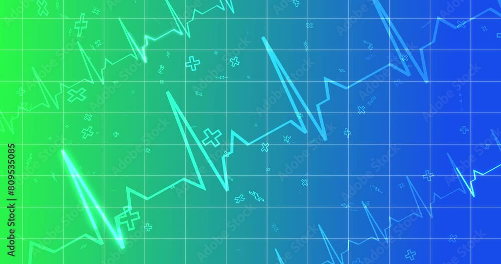 EKG ECG Cardiogram moving healthcare medical bg in 4K. Health ...