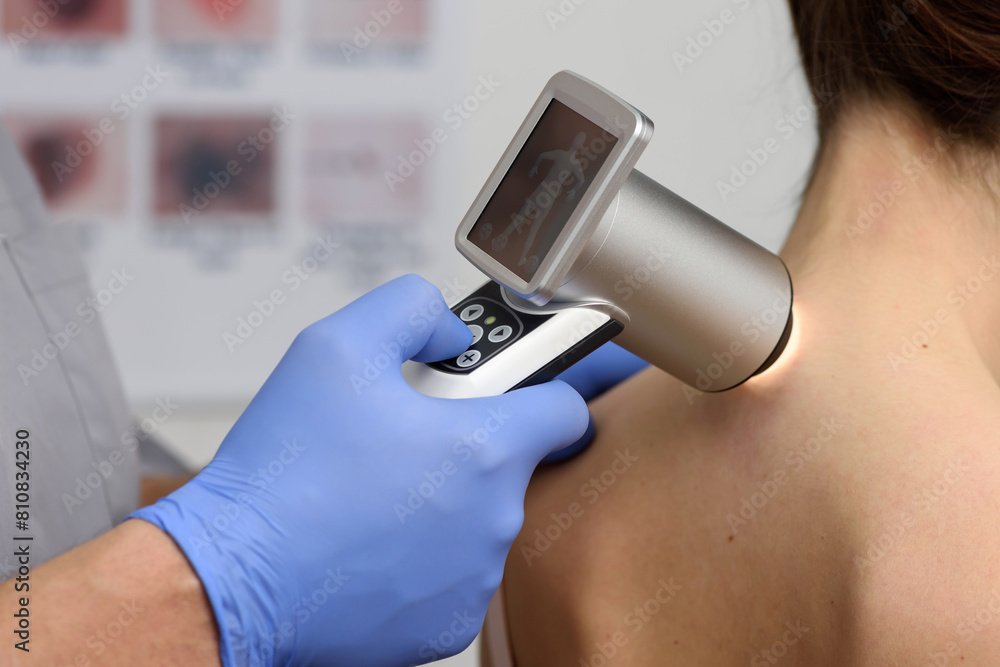 Digital dermatoscopy of moles. A dermatologist-oncologist examines the ...